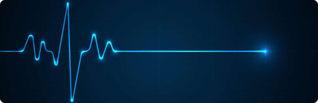 Pulseless Electrical Activity (PEA) Causes and Treatment