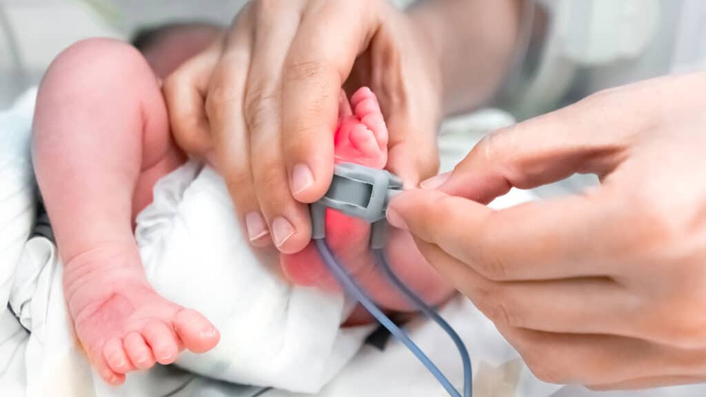 Neonatal Resuscitation Algorithm in Delivery Rooms